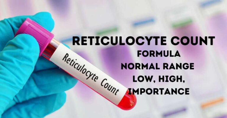 Reticulocyte Count Test: Purpose, Importance, High, Low, Complete ...