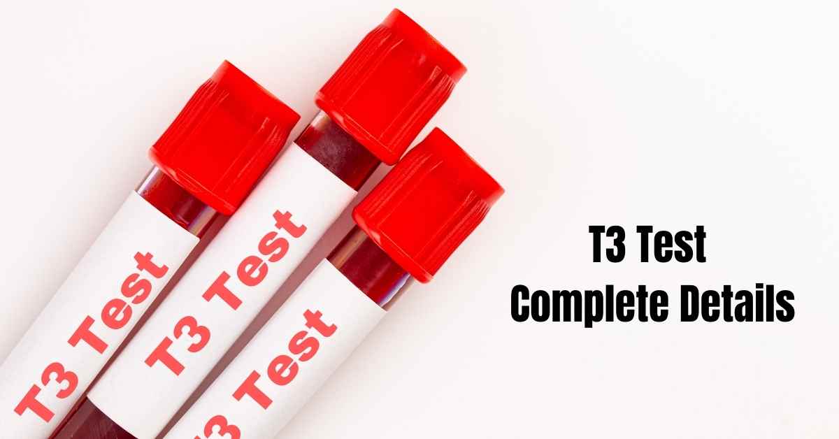 T3 Test – DoctorOnHealth