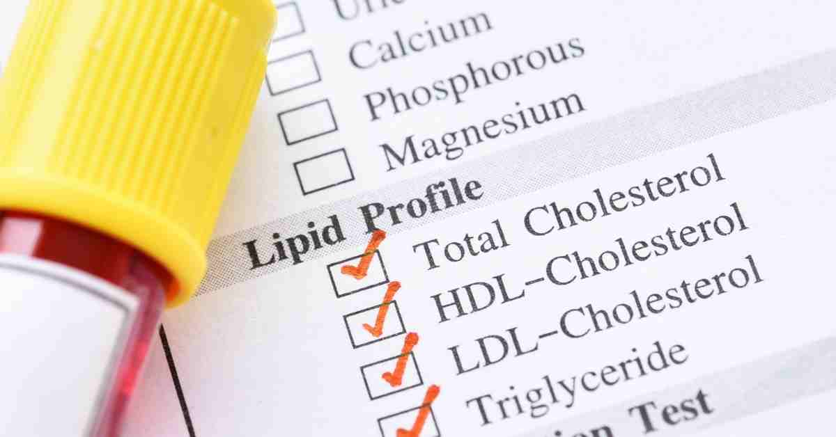 Lipid Profile Test – DoctorOnHealth