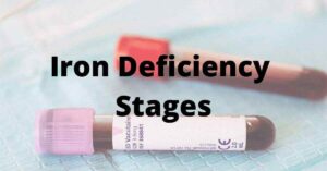 What are the three stages of iron deficiency – DoctorOnHealth